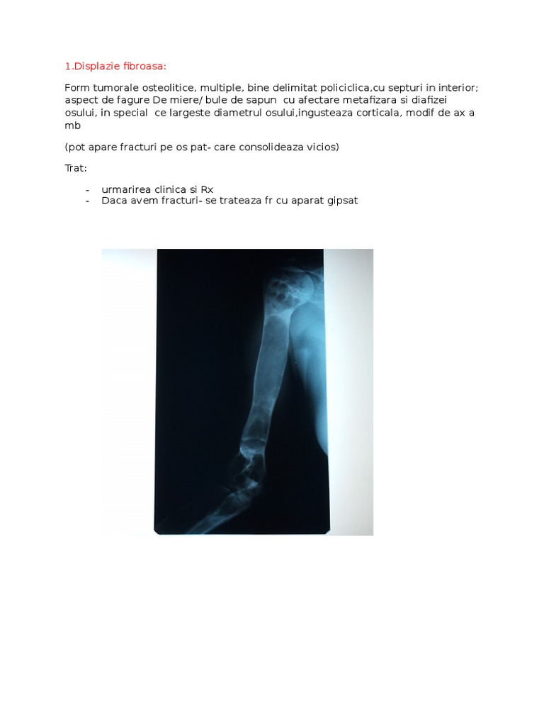 Displazie fibroasă: caracteristici și tratament | PDF | Deportes