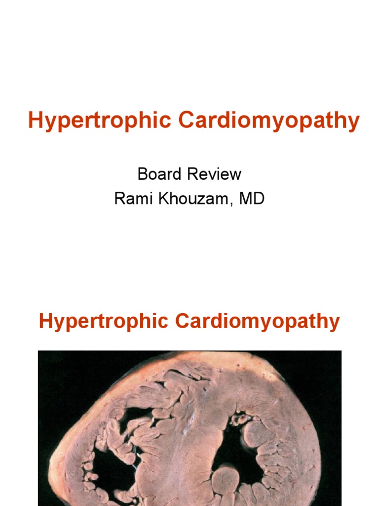 Hypertrophic Cardiomyopathy Overview | PDF | Heart Valve | Heart