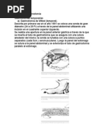 Pasos Quirúrgicos para La Cesárea Tipo Kerr | PDF | Abdomen | Seccion ...