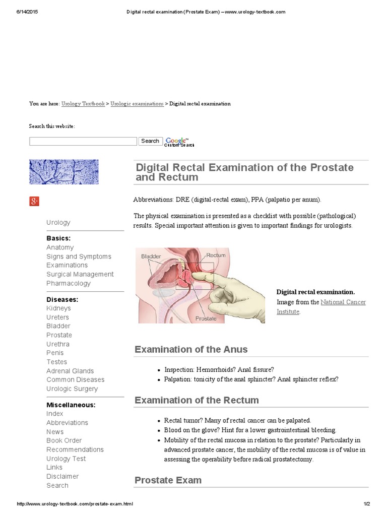 Digital Rectal Examination (Prostate Exam) - WWW - Urology-Textbook | PDF