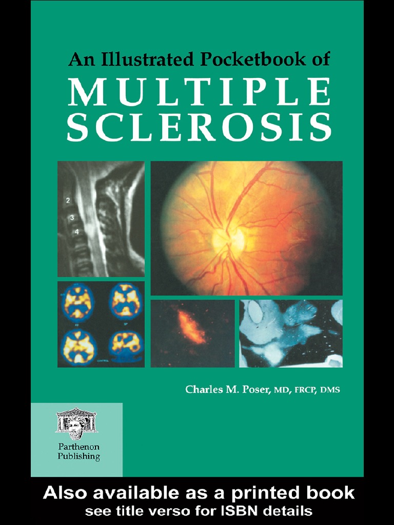 An Illustrated Pocketbook of Multiple Sclerosis | PDF | Multiple ...