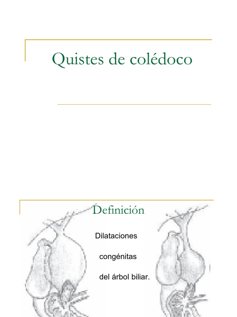 Quiste de coledoco | Sistema digestivo | Gastroenterología | Prueba ...