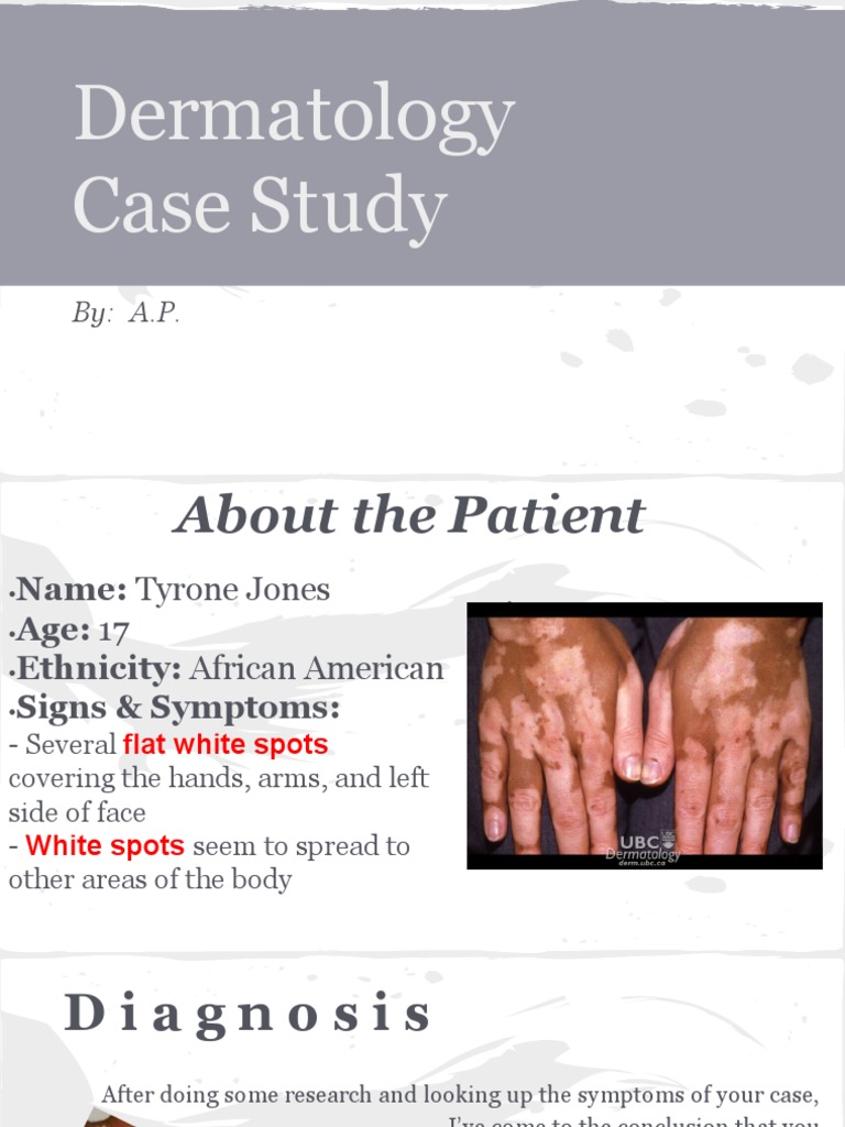 Dermatology Case Study: By: A.P | PDF