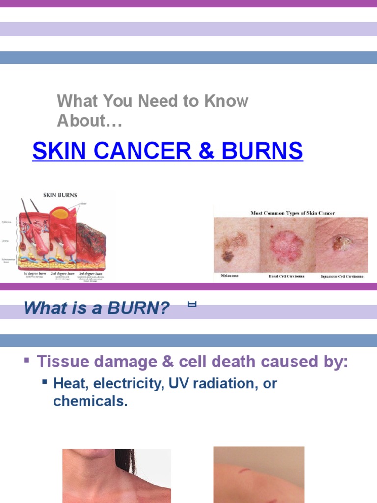 Skin Cancer and Burns | PDF | Self-Improvement | Wellness