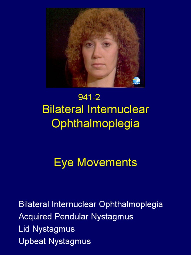 Bilateral Internuclear Ophthalmoplegia | PDF | Vision | Neuroscience