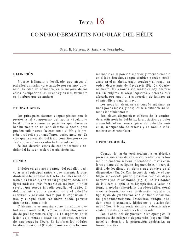 Condrodermatitis Nodular Del Helix | Inflamación | Dolor