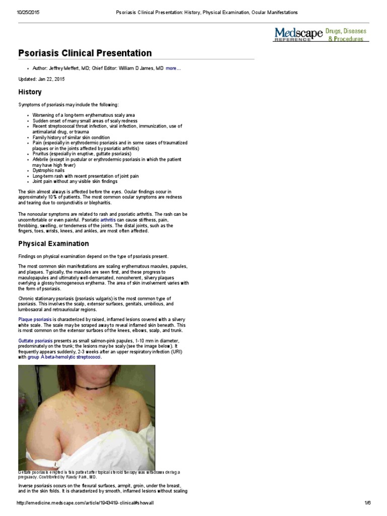 Psoriasis Clinical Presentation - History, Physical Examination, Ocular ...