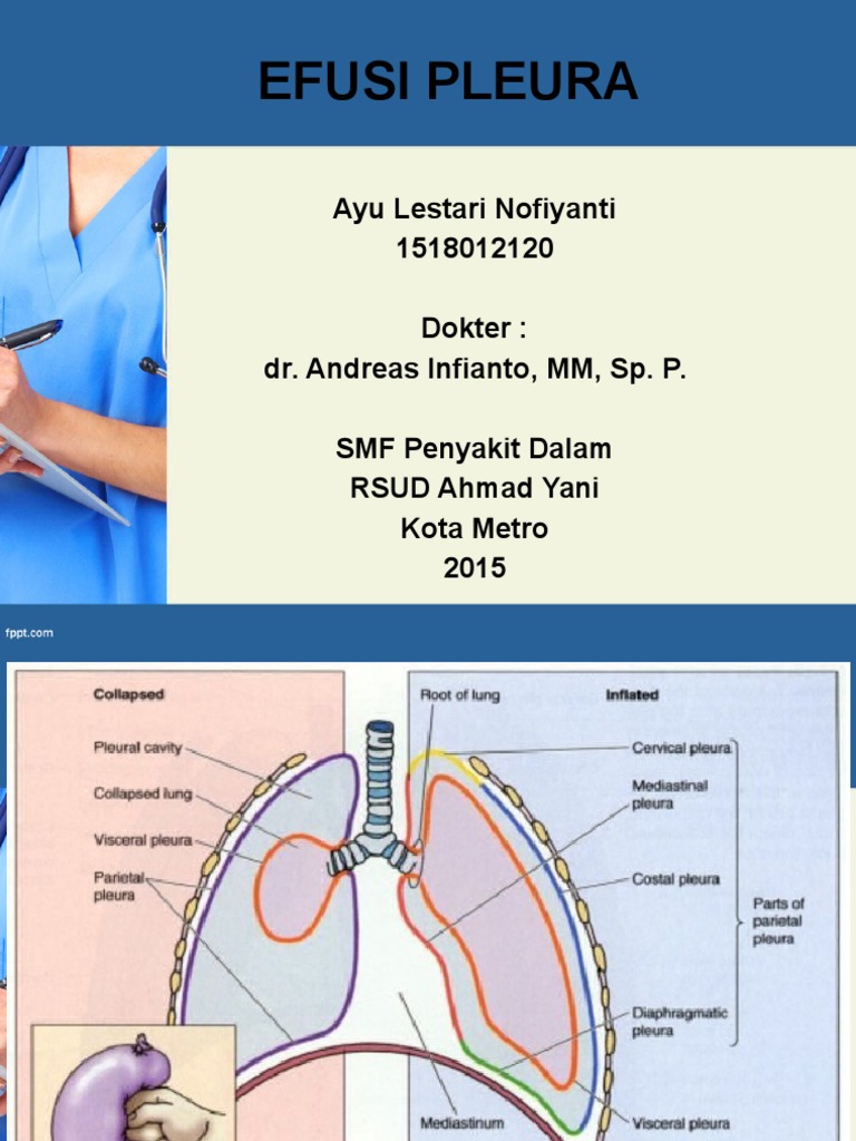 Efusi Pleura: Diagnosis & Penanganan | PDF
