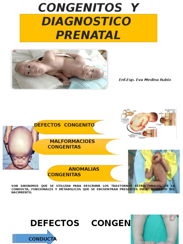 Defectos Congenitos y Diagnostico Prenatal | El embarazo | Enfermedades ...