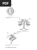 Stamm Gastrostomy Procedure Guide | PDF | Surgical Suture | Medicine
