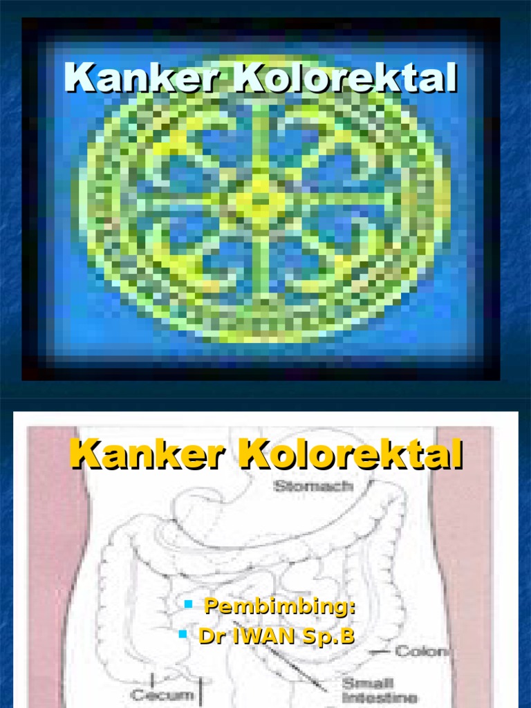 Kanker Kolorektal | PDF