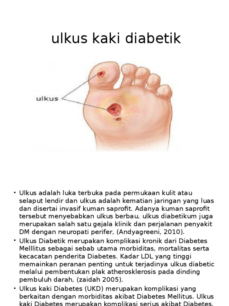 Ulkus Kaki Diabetik | PDF