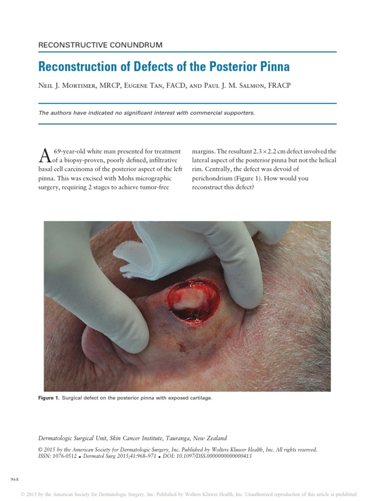 Reconstruction of Defects of The Posterior Pinna.15 | PDF | Surgery | Ear