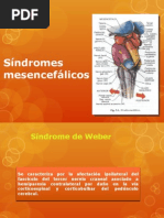 Síndromes Alternos del Tallo Cerebral | PDF | Sistema nervioso central ...