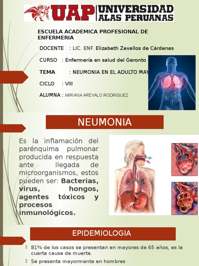 NEUMONIA EN EL PACIENTE ADULTO MAYOR | Neumonía | Pulmón