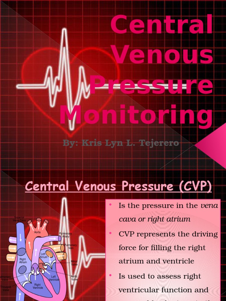 Central Venous Pressure Monitoring | Vein | Atrium (Heart)