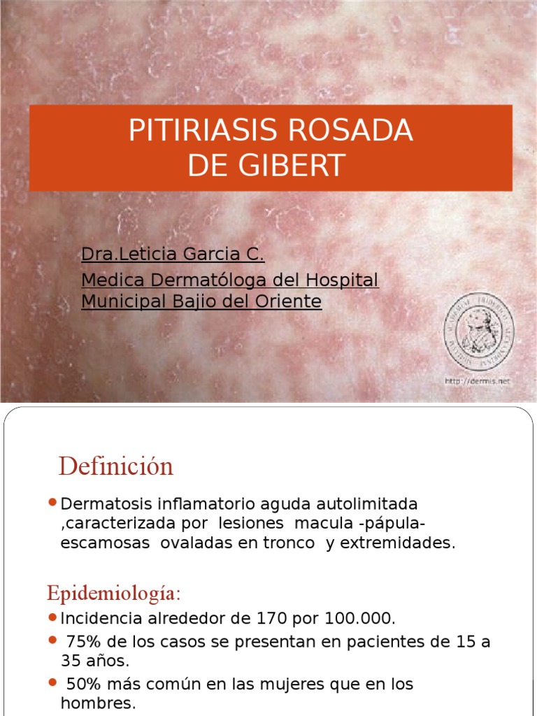 Pitiriasis Rosada | PDF | Rtt | Especialidades Medicas