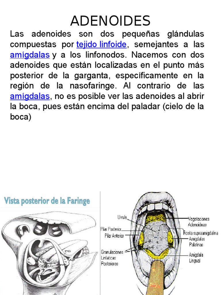 Adenoides | PDF | Especialidades Medicas | Medicina CLINICA