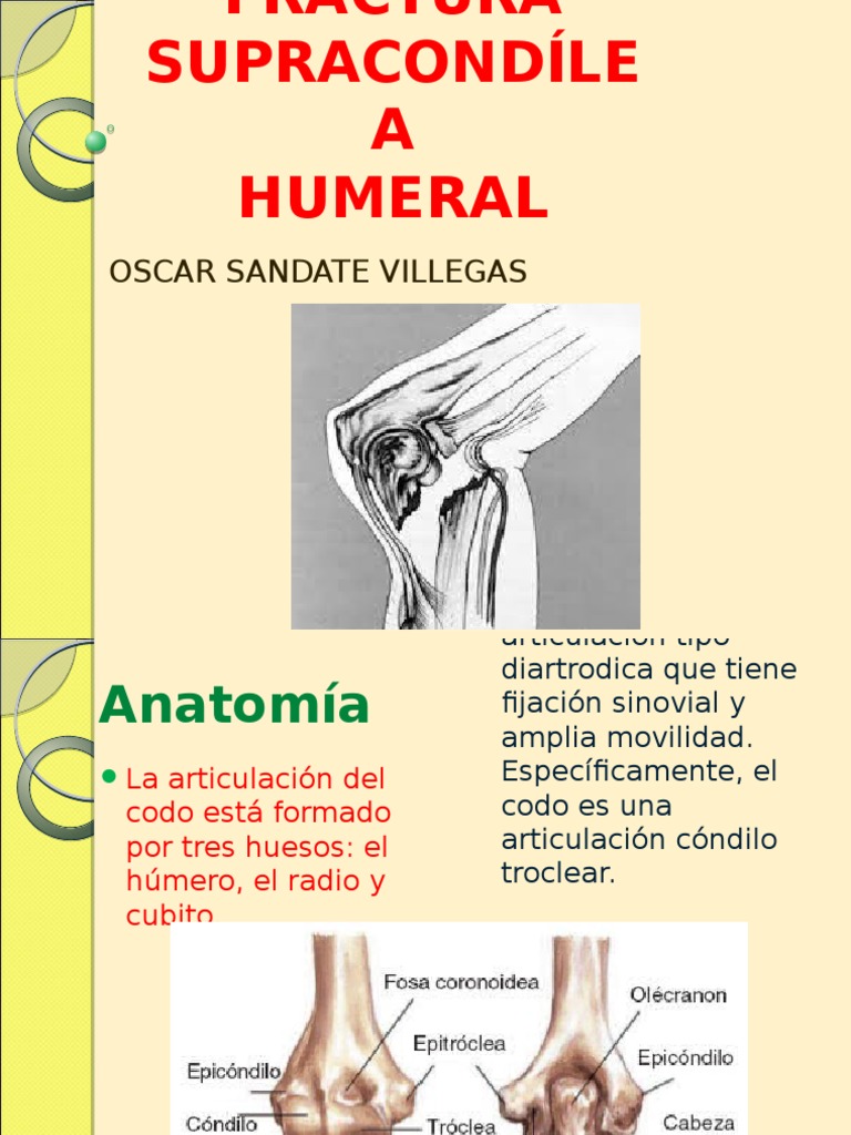 9.- FRACTURA SUPRACONDÍLEA | Codo | Extremidades (anatomía)