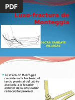 Cubito Varo y Valgo Pulgar Gatillo Dedo Boutonnier | PDF | Codo | Tendón