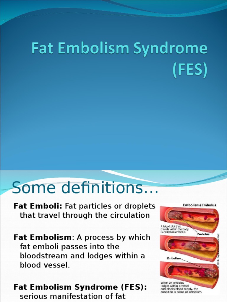 Resources - Fat Embolism Syndrome (FES) | PDF | Health Sciences ...