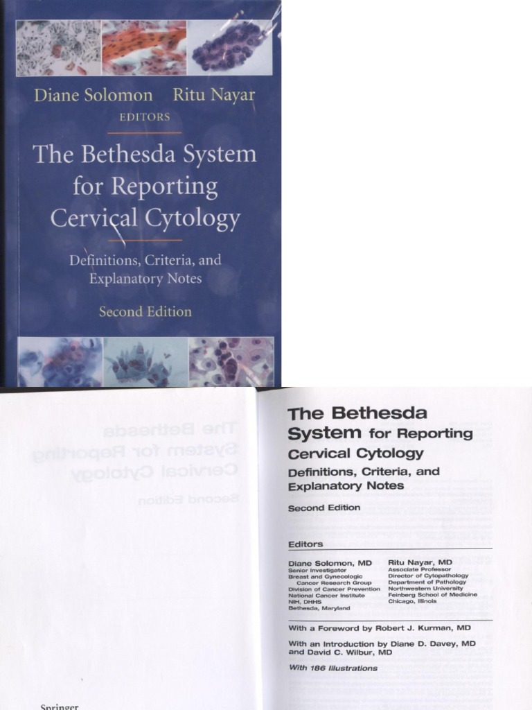 Bethesda System | PDF