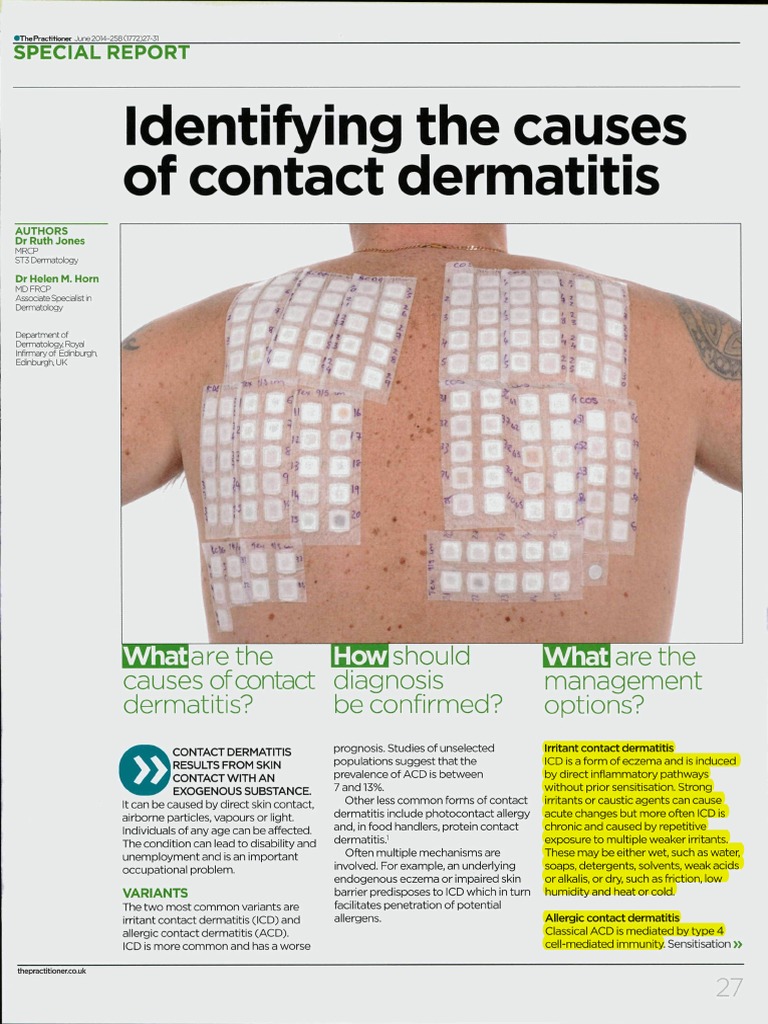 Identifying the Cause of Contact Dermatitis | Dermatitis | Topical ...