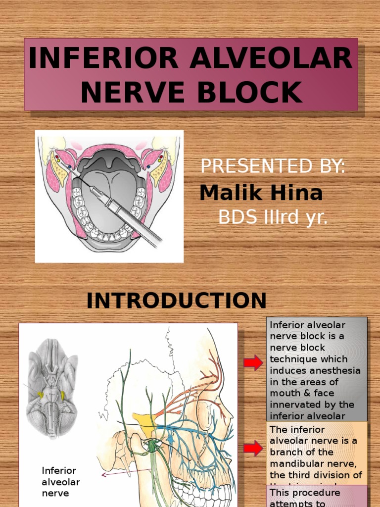 Inferior Alveolar Nerve Block Technique Video