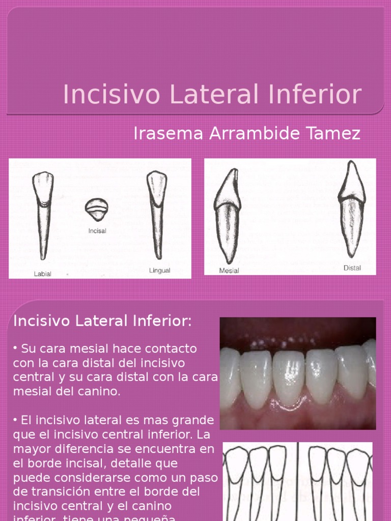 Anatomía del Incisivo Lateral Inferior | PDF | Ramas de Odontología ...