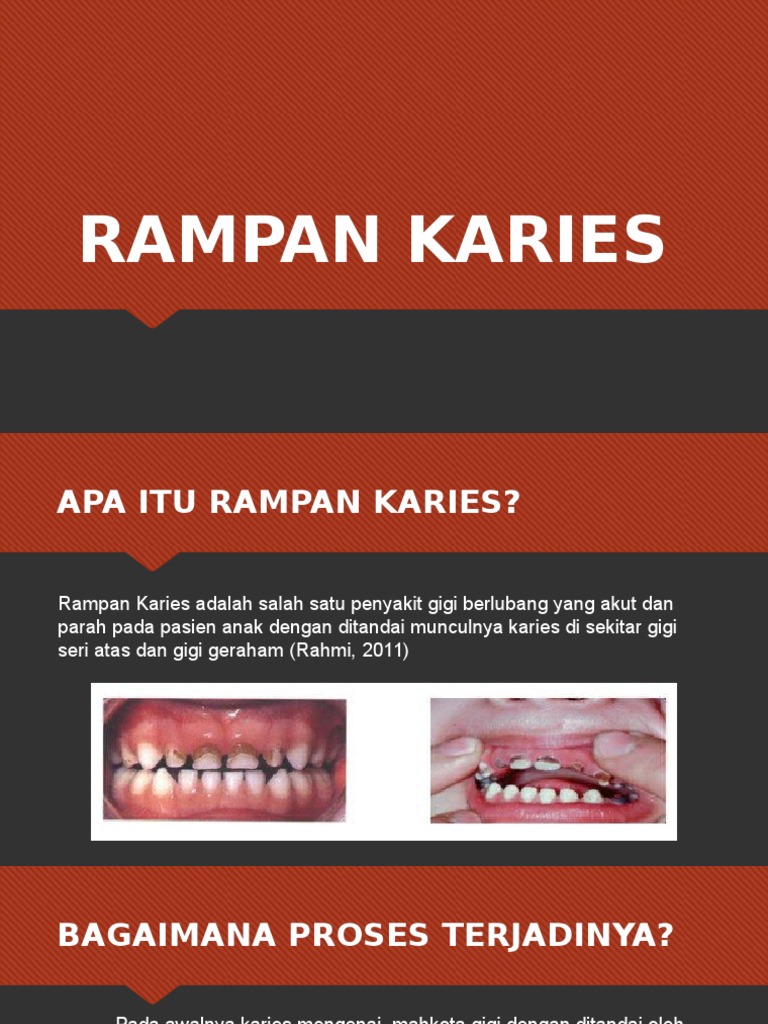 Rampan Karies | PDF