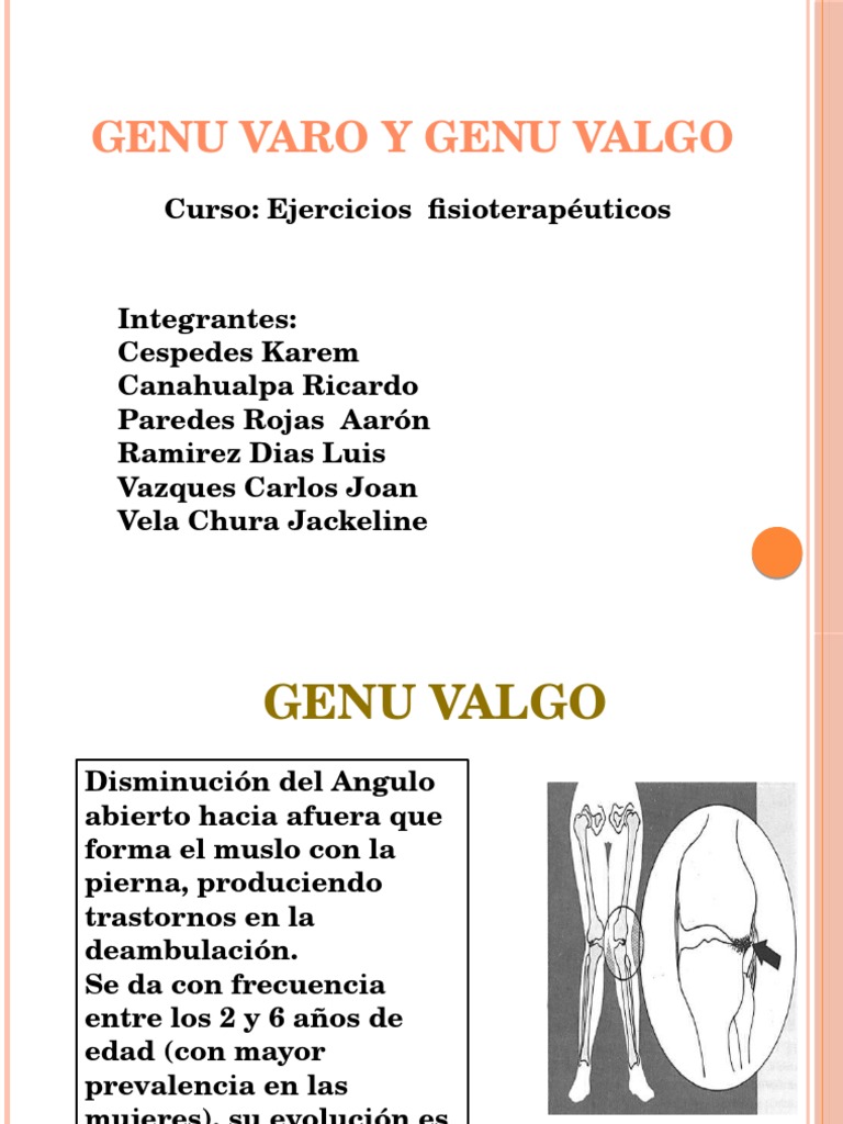 Genu Valgo y Varo. | Rodilla | Pie
