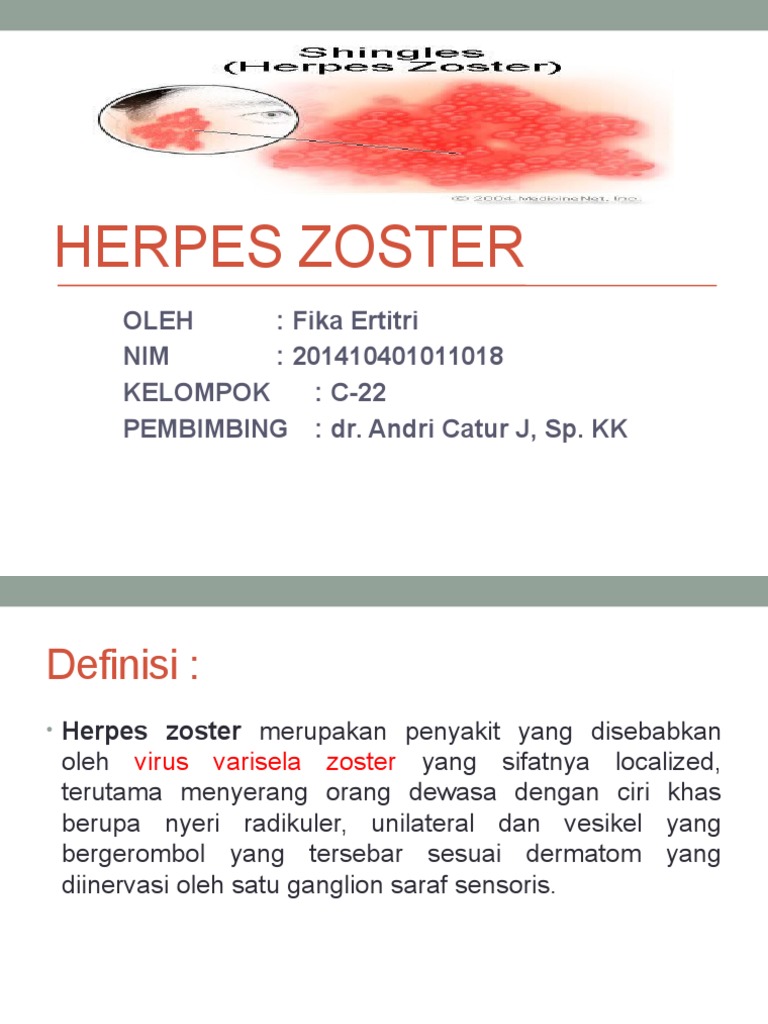 Herpes Zoster | PDF