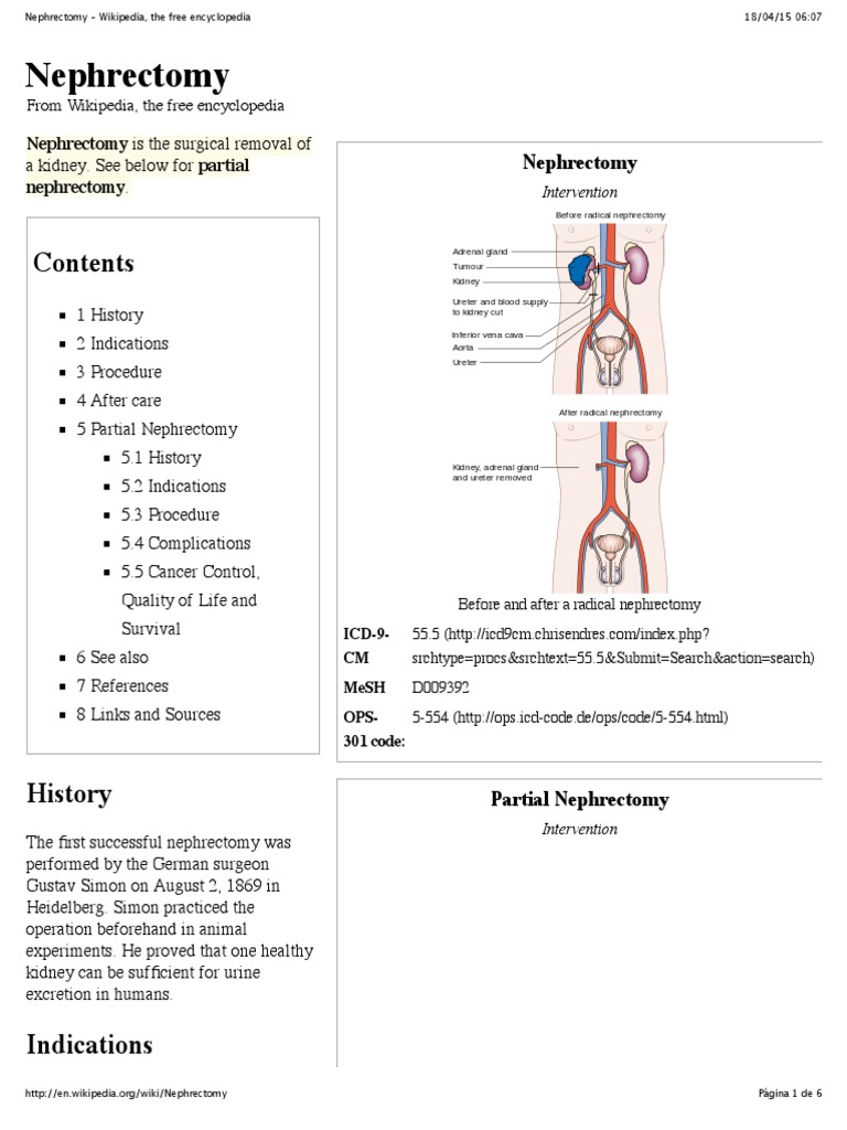 Wikipedia - Nephrectomy (CHECKED) | PDF | Surgery | Surgical Specialties