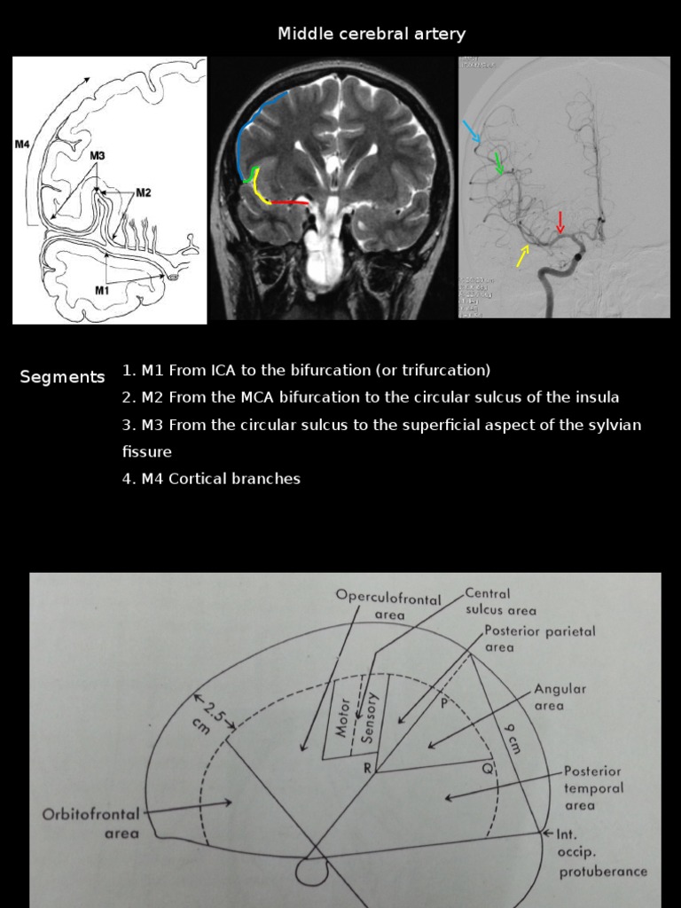 Middle Cerebral Artery Segments Explained | PDF
