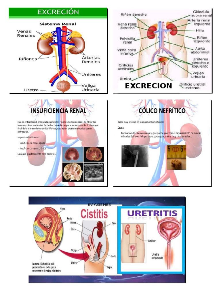 Excreción en Animales | Riñón | Orina