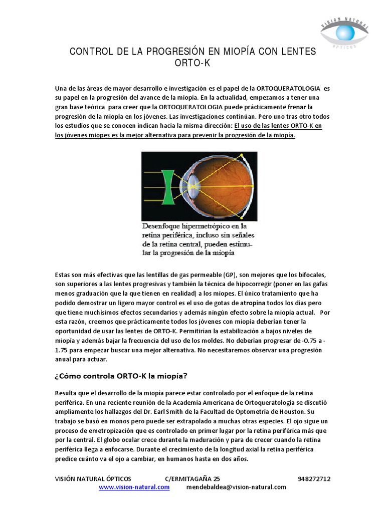 Control Miopia | PDF | Ojo humano | Lentes