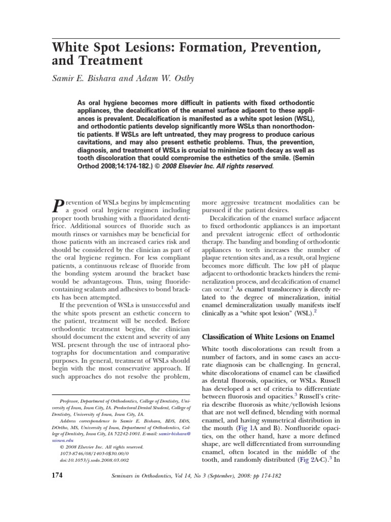 White Spot Lesion Formation Prevention Treatment | PDF | Tooth Enamel ...
