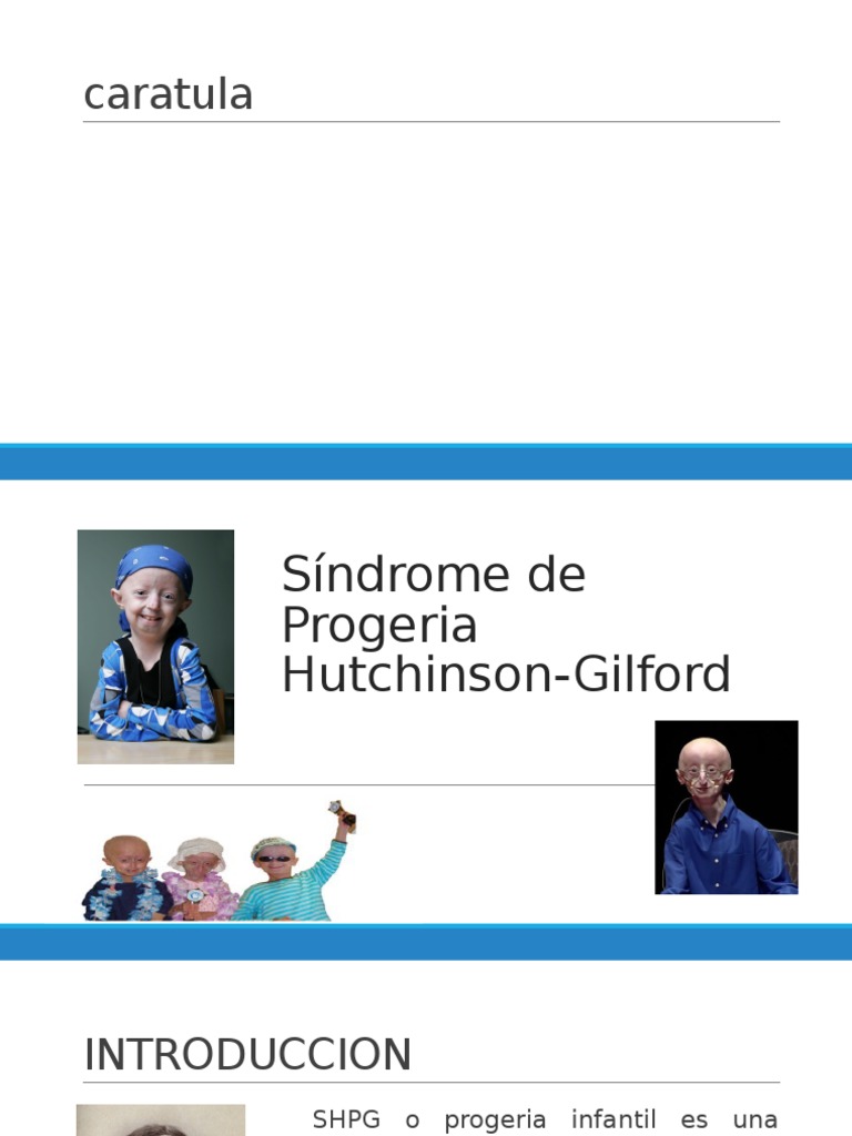 Síndrome de Progeria Hutchinson-Gilford | PDF | Salud y bienestar