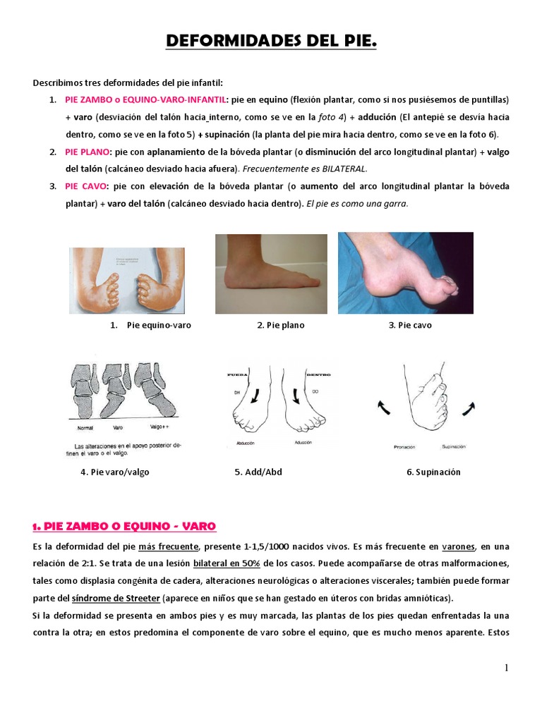 Deformidades del Pie Infantil: Tipos y Tratamiento | PDF