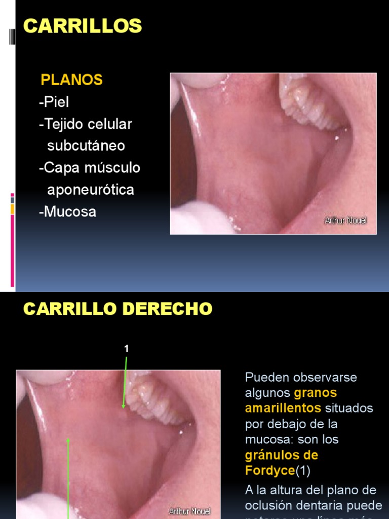 CARRILLOS.pptx | Lengua | Cabeza y cuello humanos