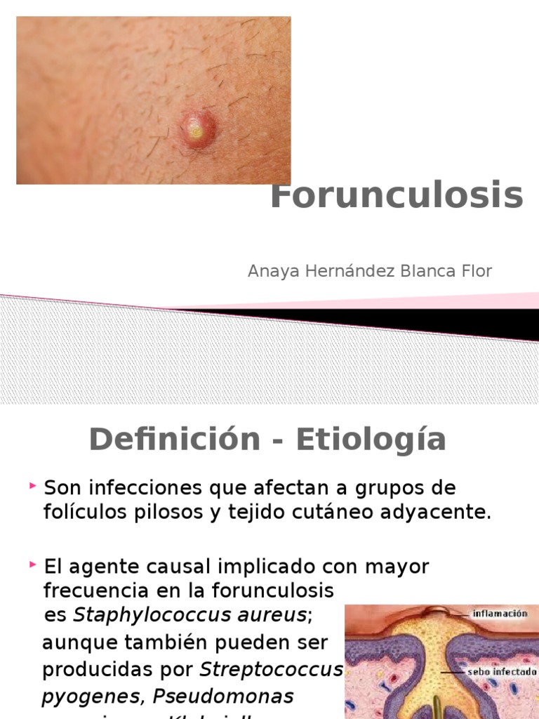 Forunculosis | Piel | Epidemiología
