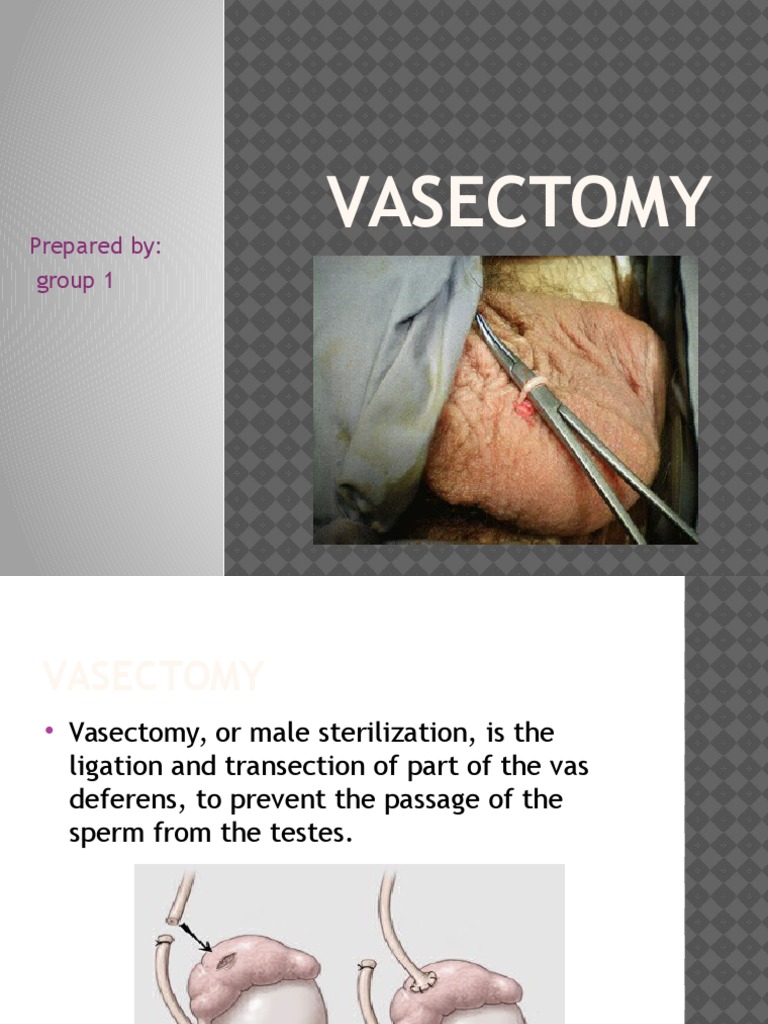 Comprehensive Guide to Vasectomy Care | PDF | Self-Improvement | Wellness