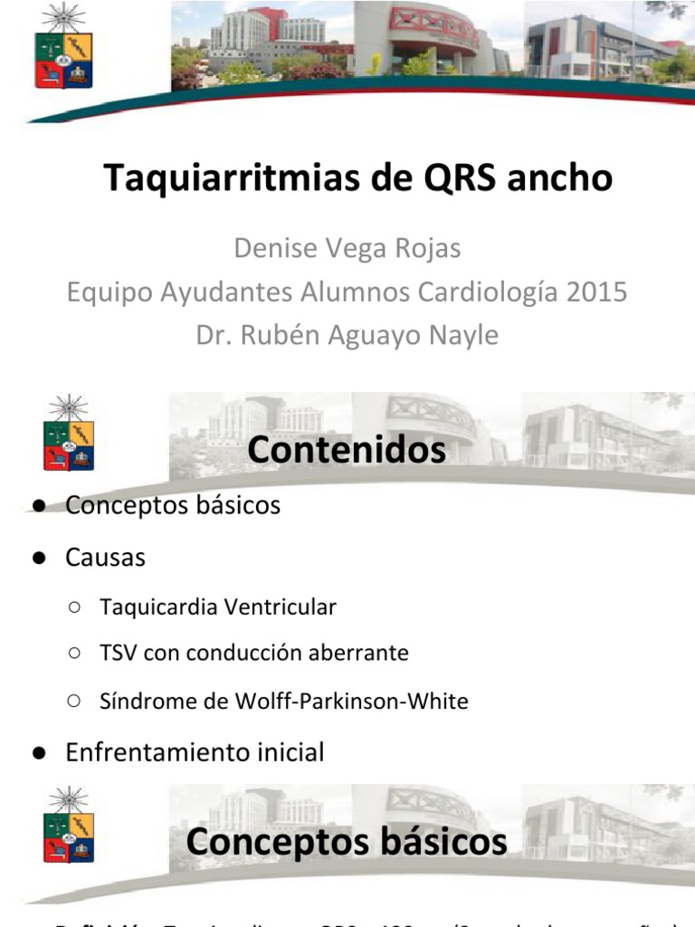 Taquiarritmias de QRS Ancho | PDF | Arritmia cardiaca | Sistema ...