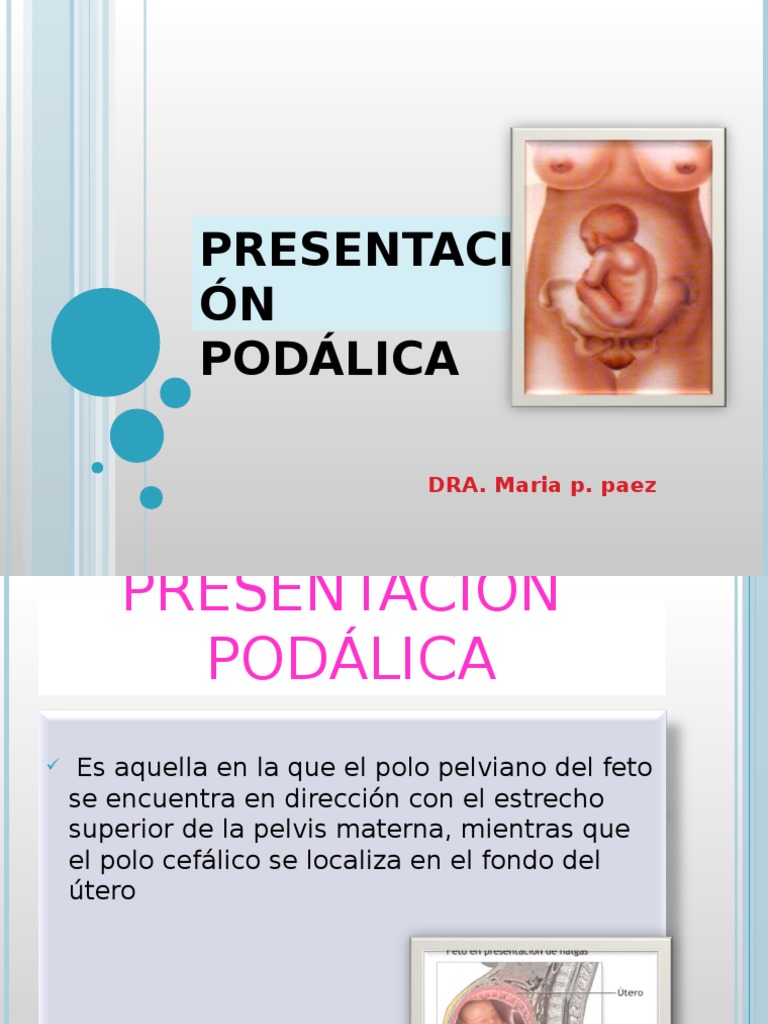 Presentación Podálica!!!! | Parto | Pelvis