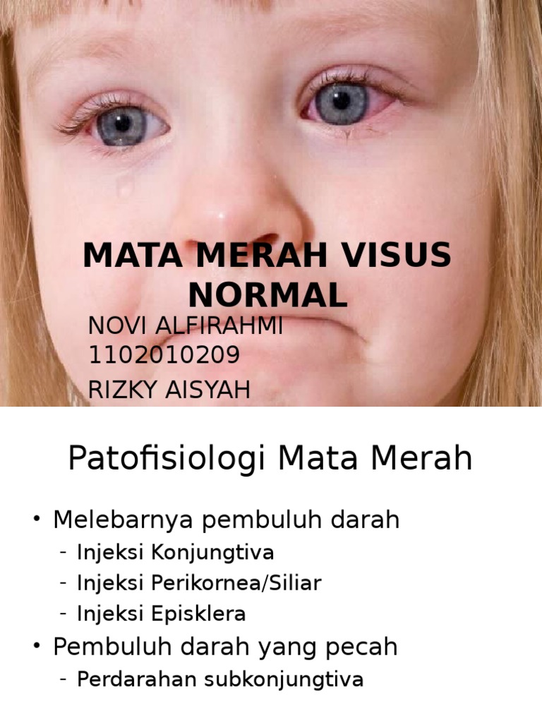 Mata Merah Visus Normal | PDF