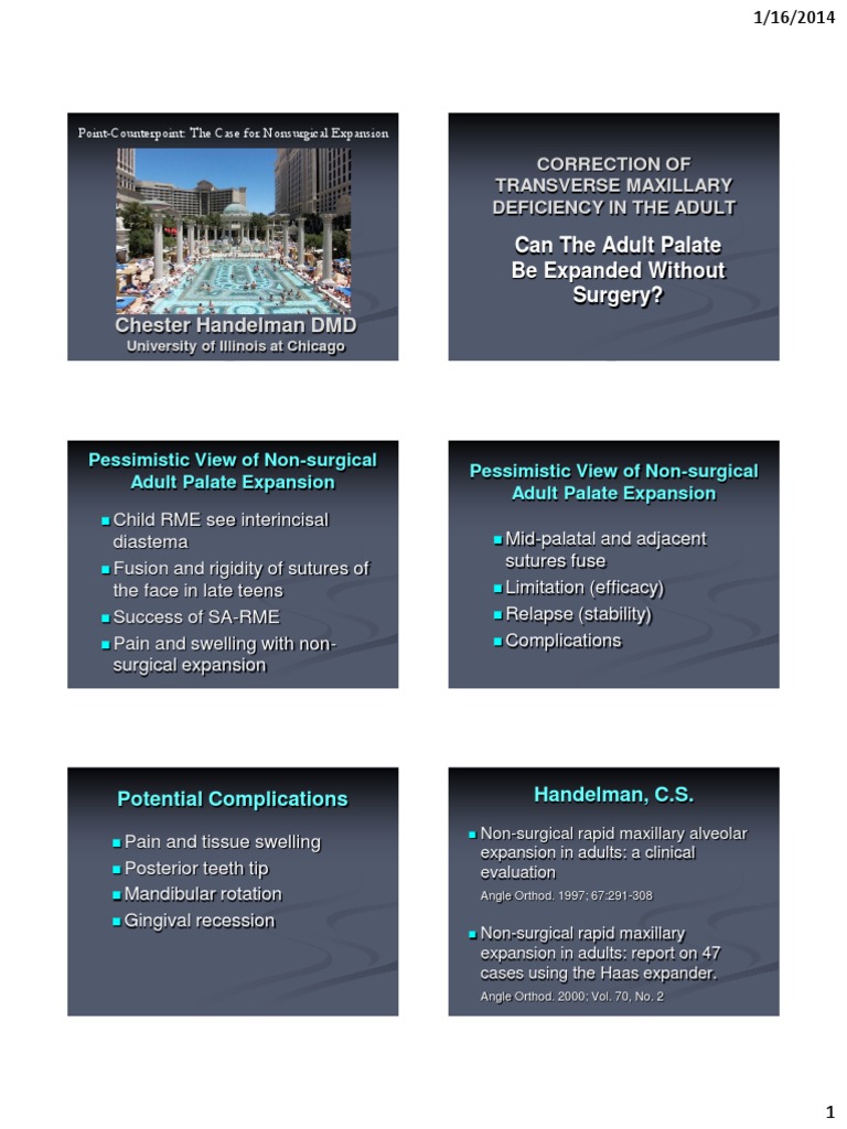 Handleman - Point The Case For Nonsurgical Expansion | Download Free ...
