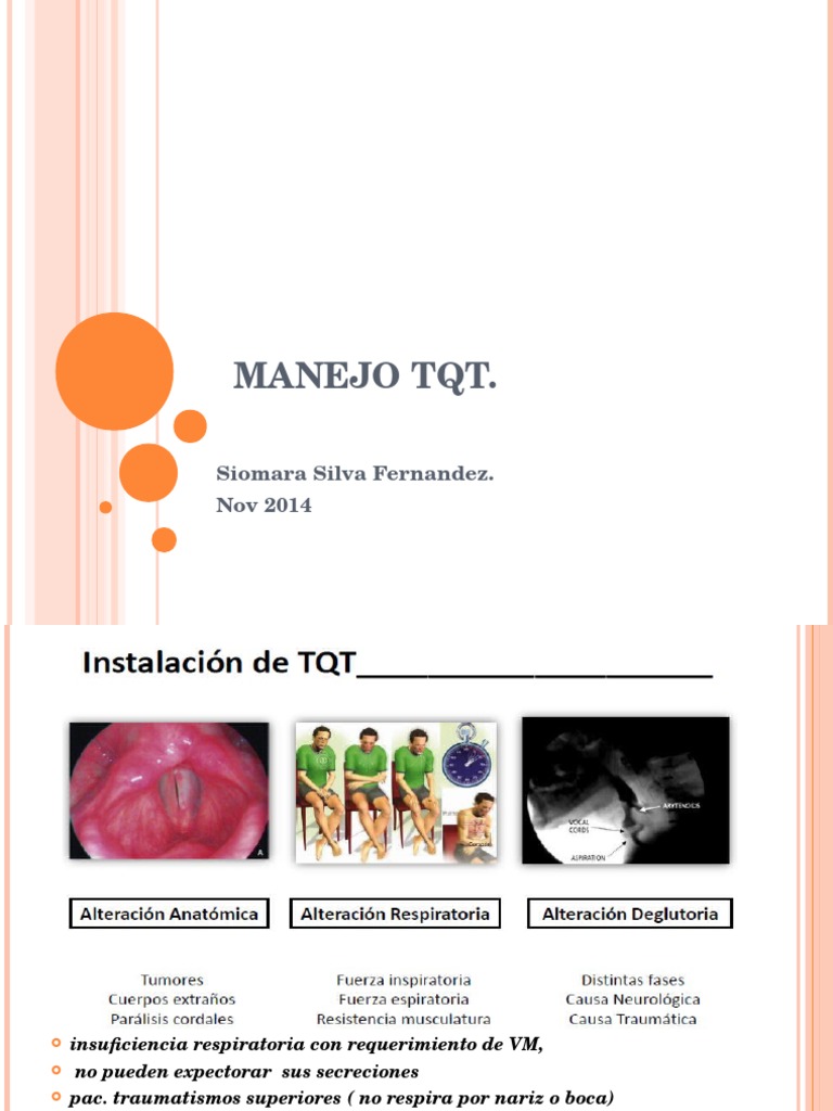 Manejo TQT | PDF | Sistema respiratorio | Tos