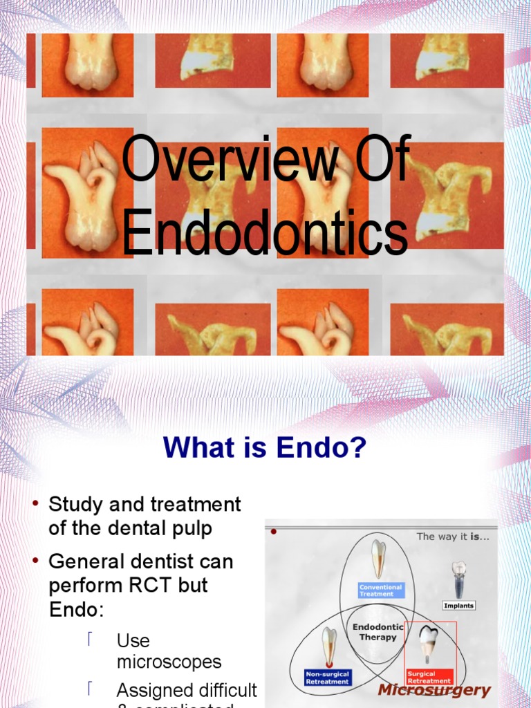 Endo Overview | Download Free PDF | Dentistry Branches | Medicine