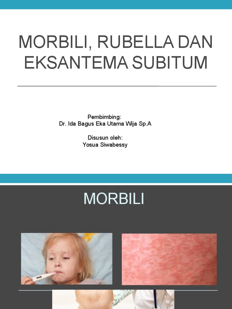 Presentasi Referat (Morbili, Rubella, Eksantema Subitum) | PDF | Sains ...