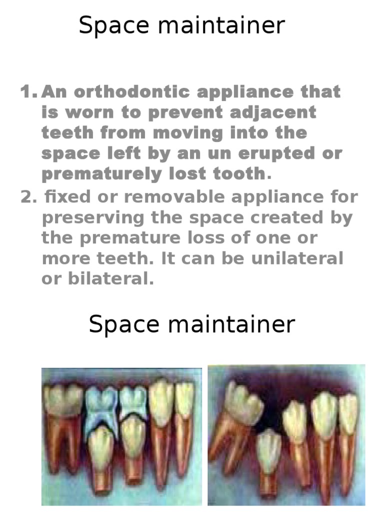 Space Maintainer | PDF | Language Arts & Discipline | Foreign Language ...